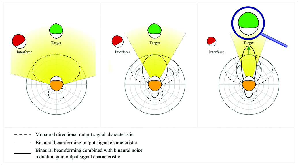 New Binaural Strategies for Enhanced Hearing - Hearing Review